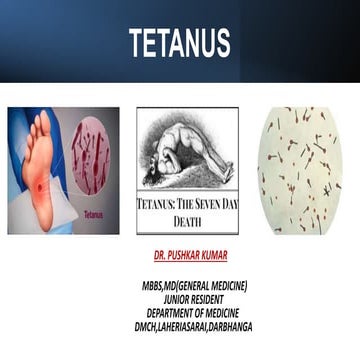 Tetanus.pptx