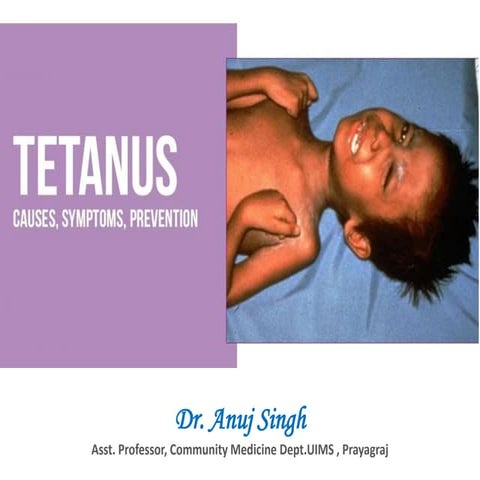 TETANUS | PPTX