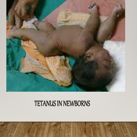 Tetanus in newborns. CONDITIONS FOR THE SICK CHILDREN. | PPTX