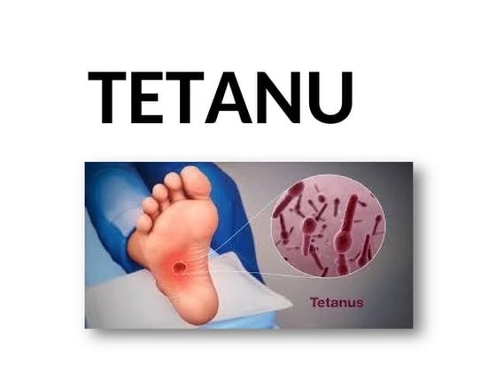 Tetanus Infection Foot When To Get A Tetanus Shot After A Cut