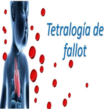 Tetralogia de falot | PPTX