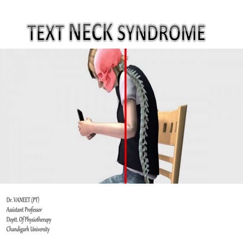 Text neck syndrome by vaneet | PPTX
