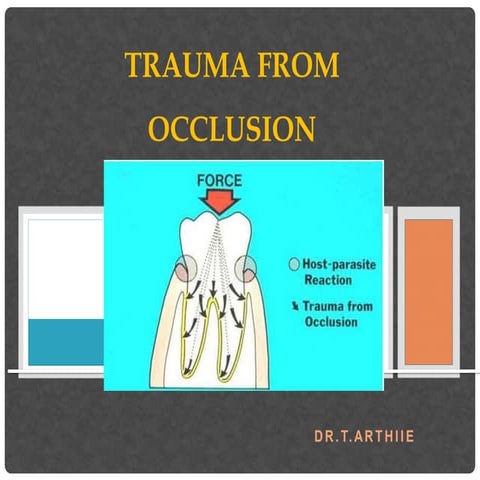 Trauma from occlusion and Pathologic migration in periodontics | PPTX