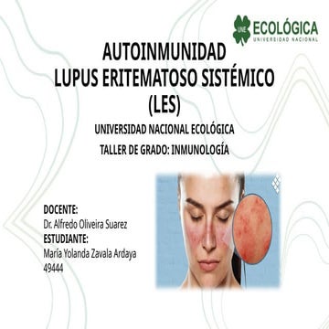TG-P AUTOINMUNIDAD (LUPUS) - Inmunidad Inespecífica | PPTX