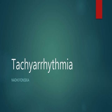Tachyarrhythmia Management | PPTX