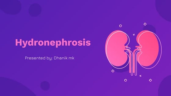 Hydronephrosis disease presentation for nurse | PPT