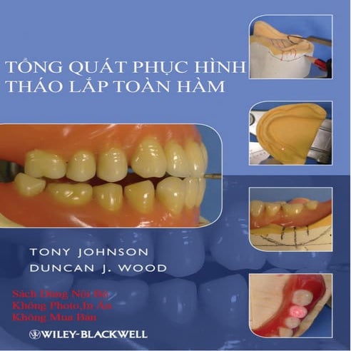 Ips+e max+clinical+guide | PDF