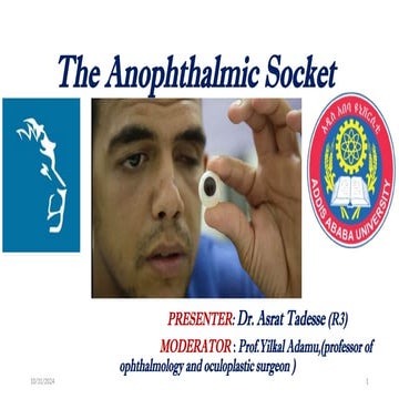 The Anophthalmic Socket .Dr.Asrat Tadesse | PPTX