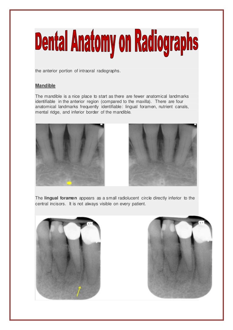 The anterior portion of intraoral radiographs
