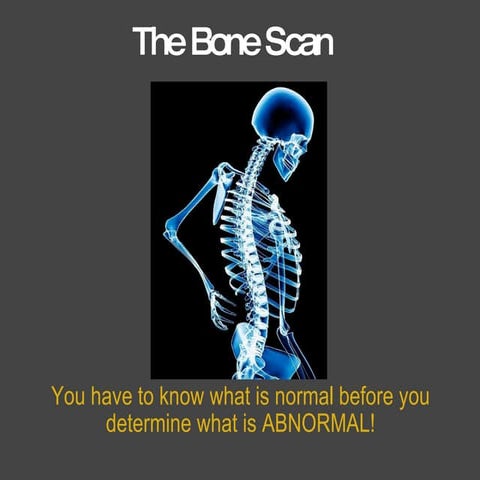 The Bone Scan | PPT