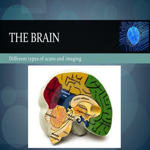 The brain - scans and imaging | PPT