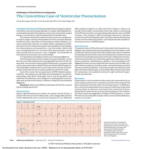 DDELTA WAVE IN ECG AND ITS INTERPRETATION IN ECG | PPTX