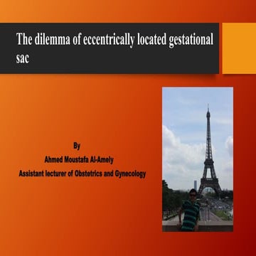 The dilemma of eccentrically located gestational sac | PPTX