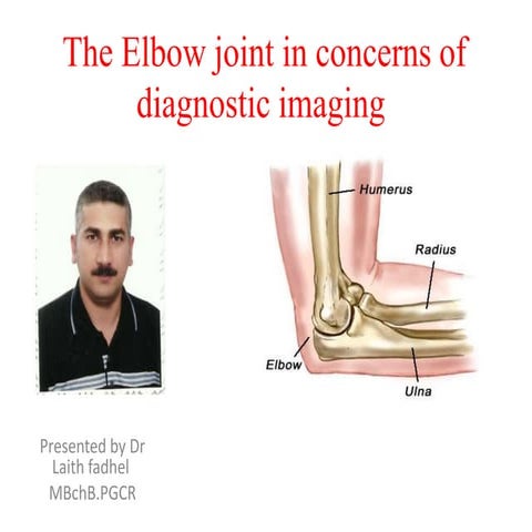 The elbow joint in concern of diagnostic imaging .pptx 1 | PPTX
