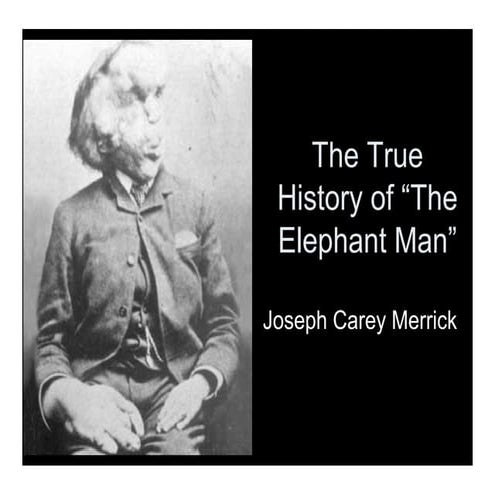 The elephant man (the real story)real | PDF