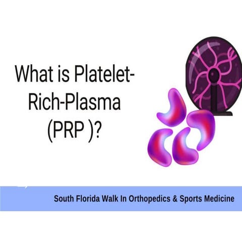 The facts about platelet rich plasma (prp) | PPTX