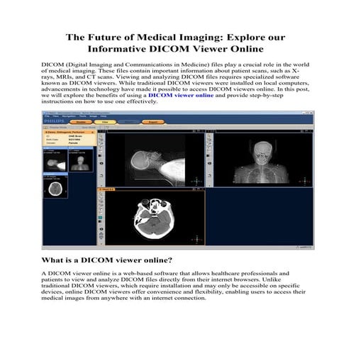 The Future of Medical Imaging Explore our Informative DICOM Viewer Online.pdf
