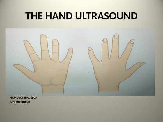 Pulley system in hand | PPTX | Death, Injury, or Military Conflict ...