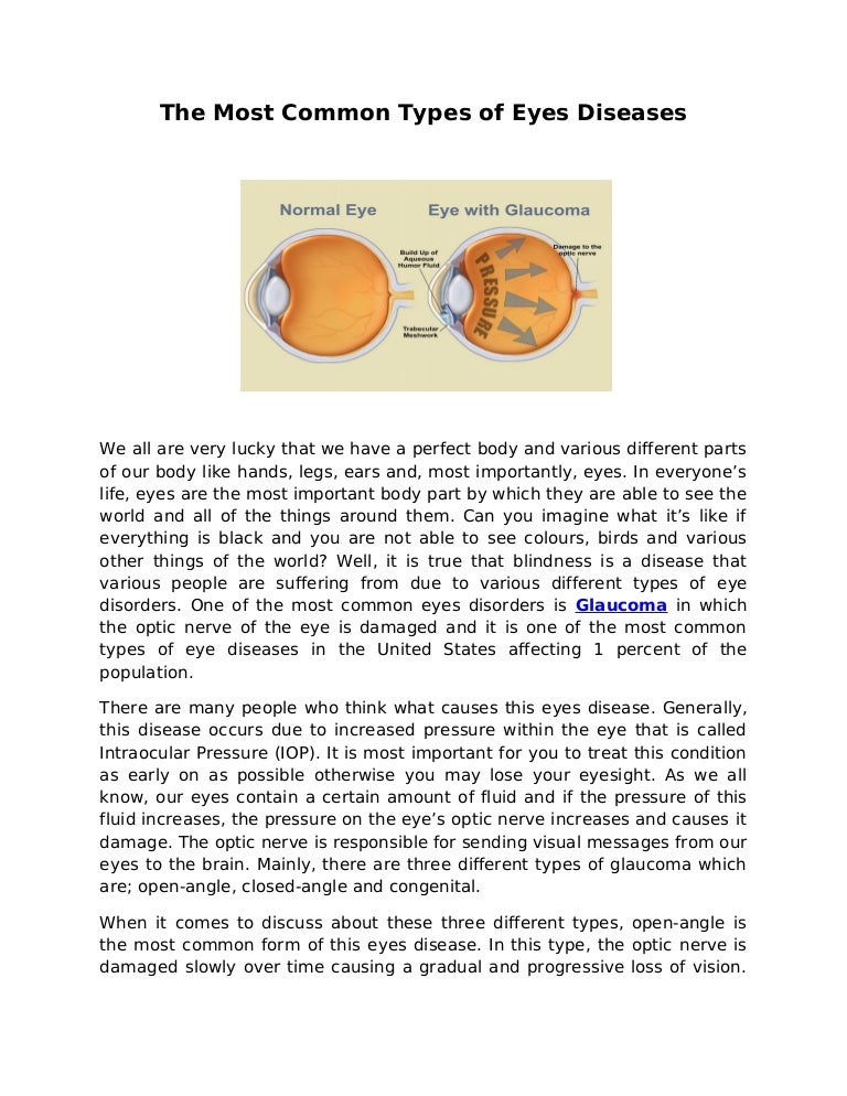 The most common types of eyes diseases