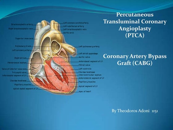 ICD -10 PCS coding 1 Cardiovascular.pptx
