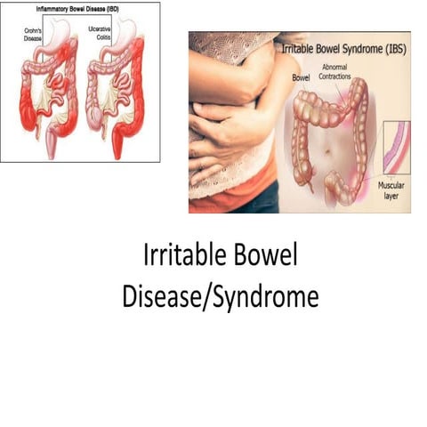 Irritable bowel disease/syndrome | PDF