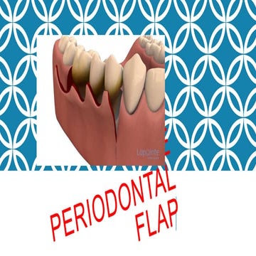 The periodontal flap | PPT