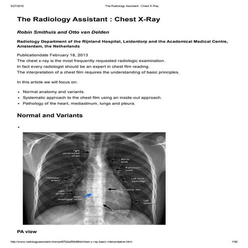 The radiology assistant chest x ray - basic interpretation | PDF