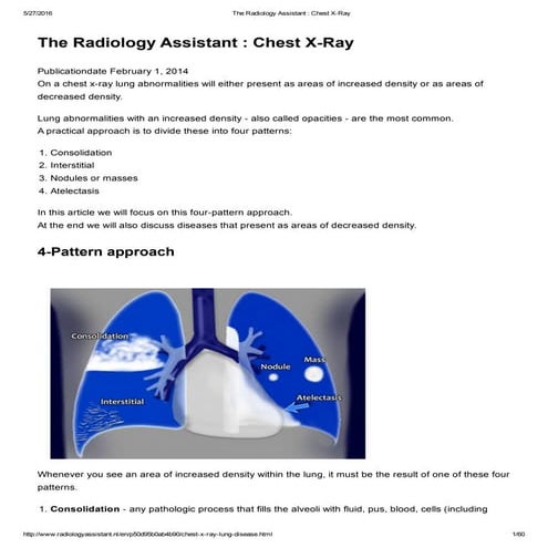The Radiology Assistant Chest X Ray Basic Interpretation Pdf