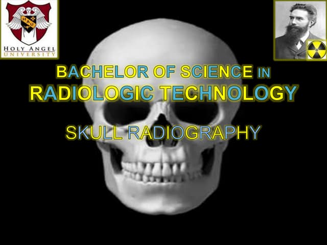TOWNE VIEW of the skull. X-ray special procedure of skull. | PPTX