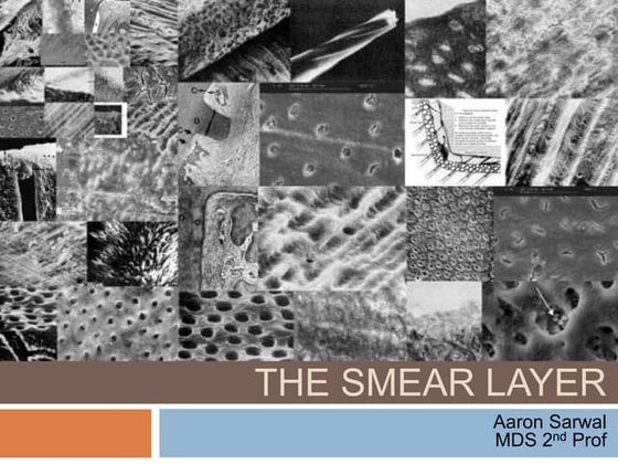 Acid Etching of Enamel and Bond Strength | PPT