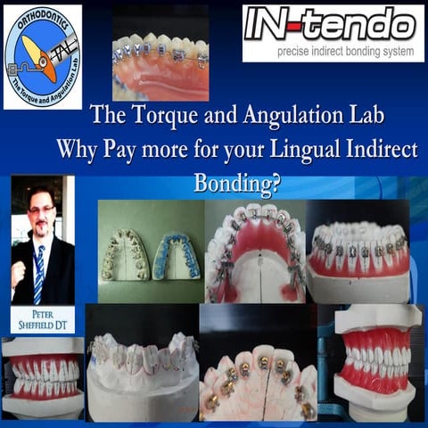 Lingual and Labial Orthodontic Indirct Bonding Services | PPT