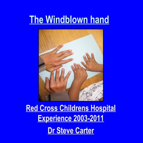 The windblown hand | PPT