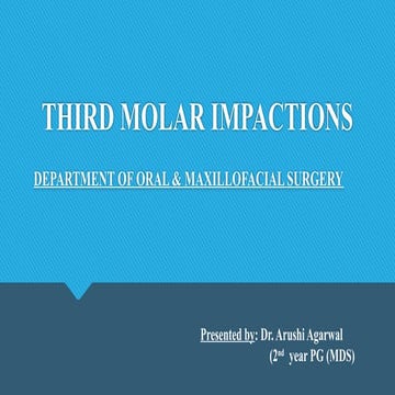 THIRD MOLAR IMPACTIONS and its management | PPTX