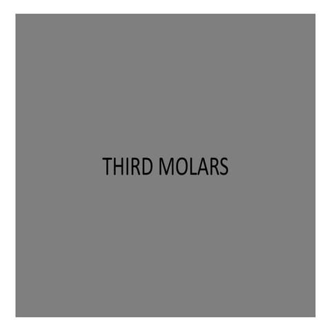 Third molars | PPTX