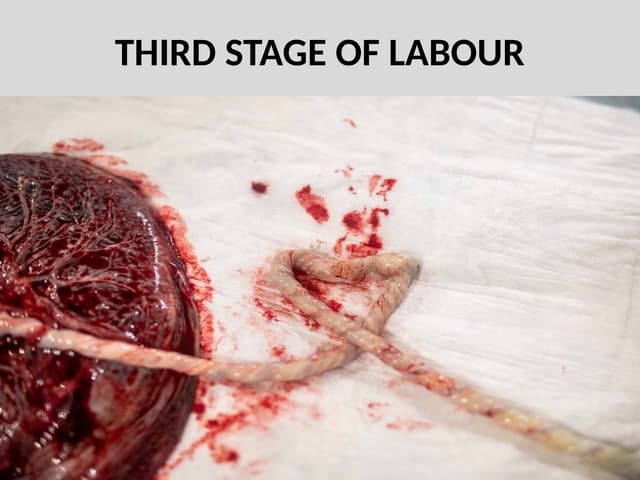 Third stage of labour | PPTX