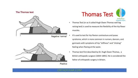 Homan’s Sign for DVT.pptx | Medical Health
