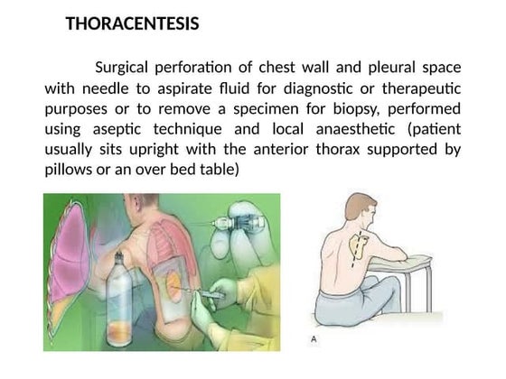 Nursing management of hemodialysis | DOCX | Healthcare Industry ...