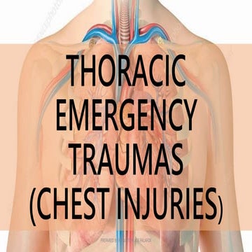 THORACIC-EMERGENCY-TRAUMAS to help us what to do | PPT