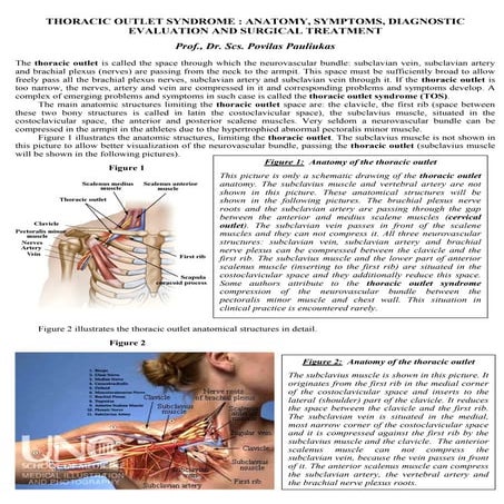 Thoracic Outlet Syndrome: Anatomy, Symptoms, Diagnostic Evaluation and ...