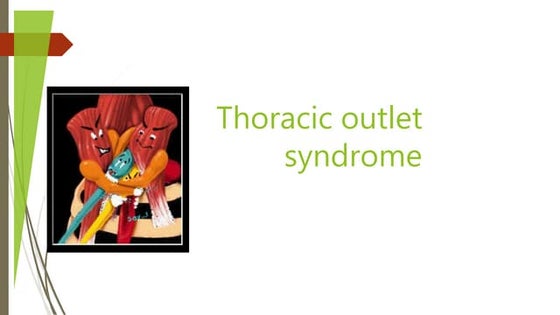 Thoracic Outlet Syndrome.pptx