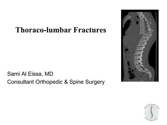 Spine Fractures Pptx
