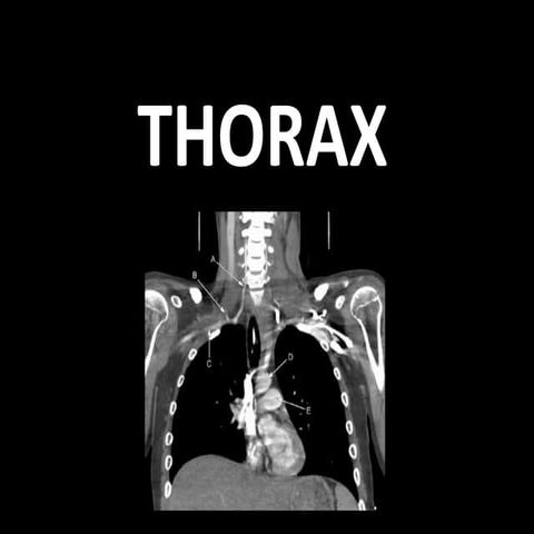 Thorax CT scan for respiratory Physicianpdf | PDF