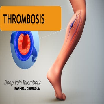 THROMBOSIS ..pptx