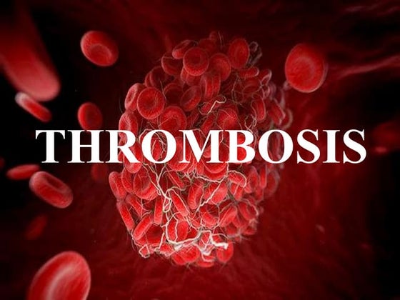 Thrombosis presentation - Pathology.ppt