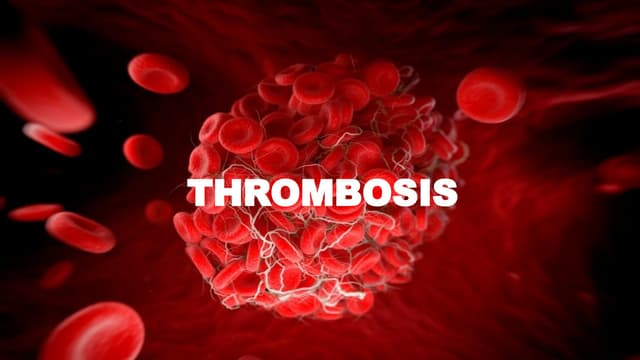 Thrombosis | PPTX