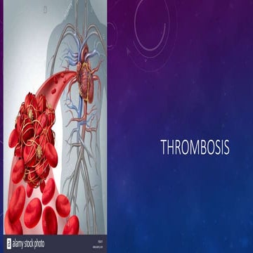 History of thrombosis | PPTX