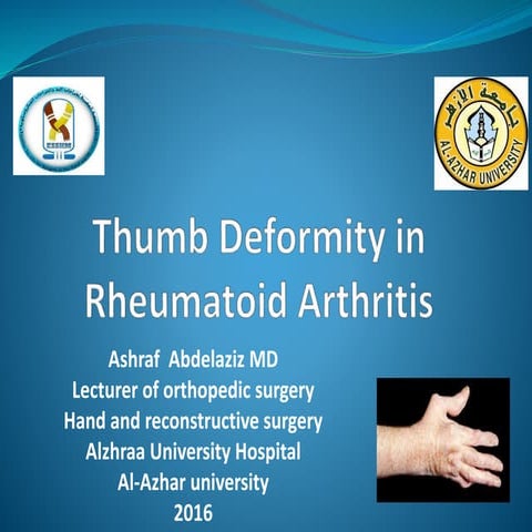 Thumb deformity | PPTX