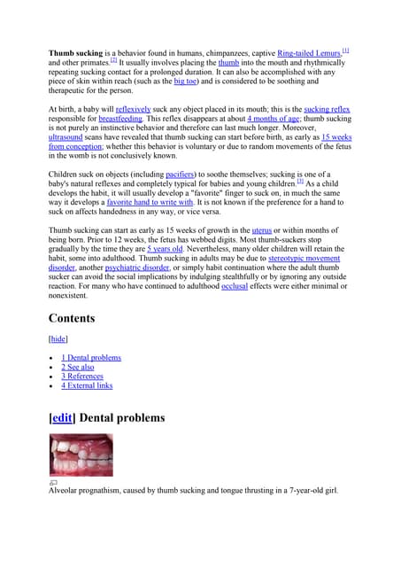 MANAGEMENTforThumbsucking(Pediatrics).pptx
