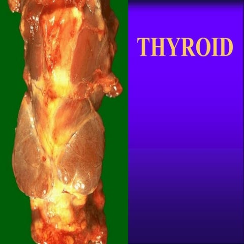 Thyroid.ppt government medical college gmc | PPT