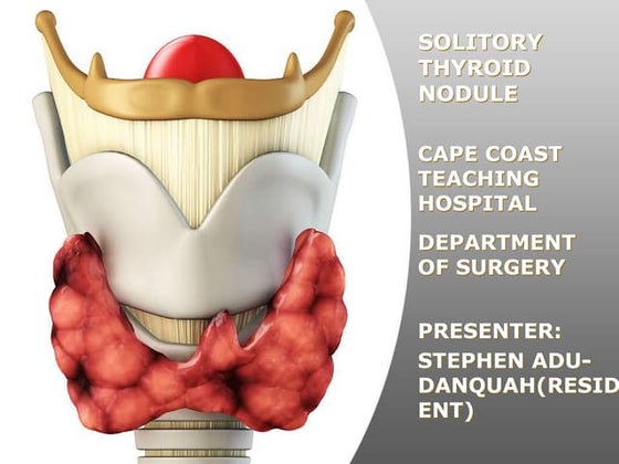 Approach to Thyroid nodule | PPTX | Thyroid Disorders | Endocrine and ...
